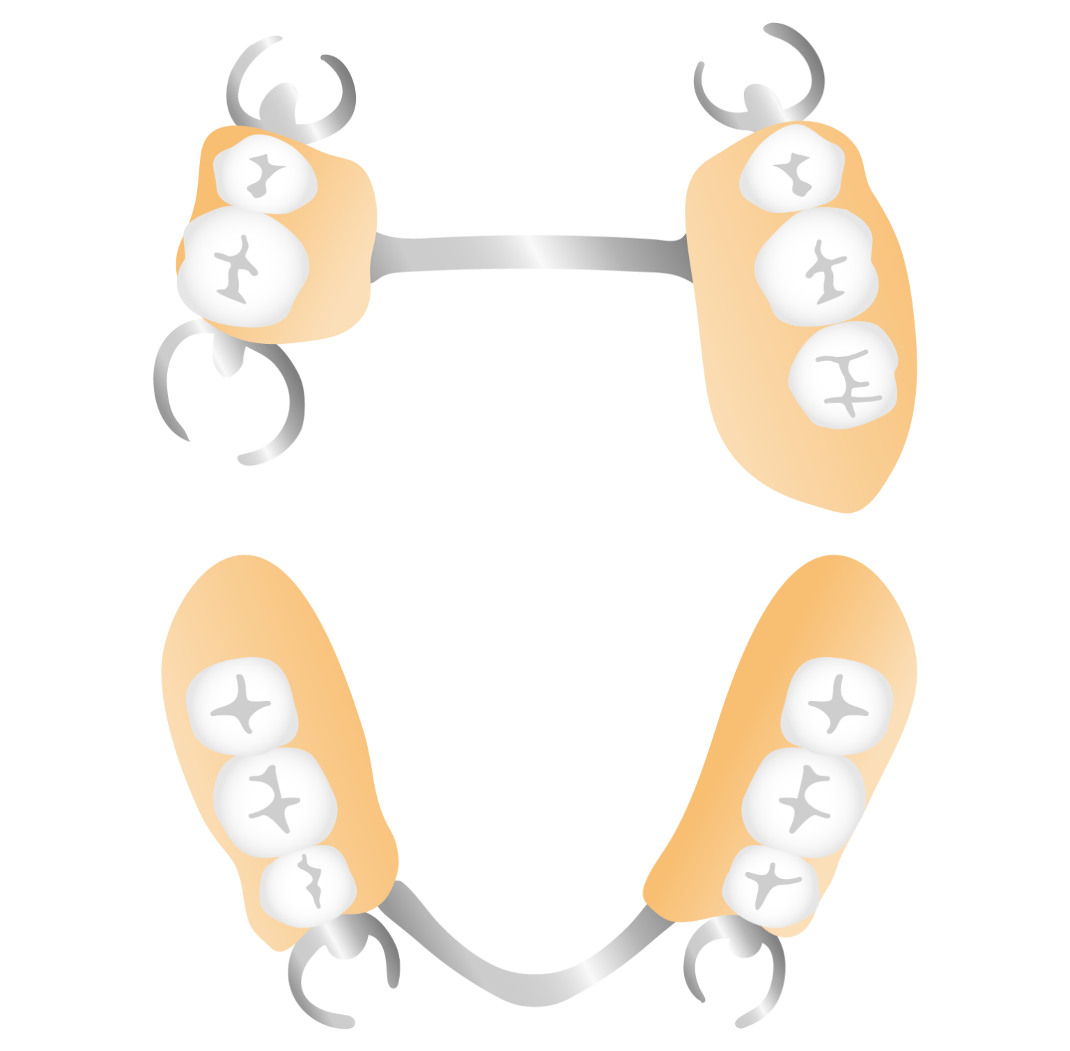 Partial Dentures to Restore Your Smile | Orange Dental